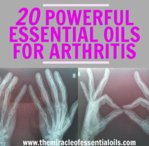 Top 20 Powerful Essential Oils for Arthritis Treatment - The Miracle of ...