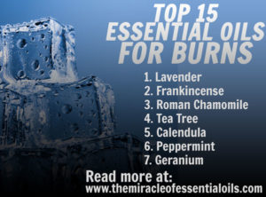 Top 15 Powerful Essential Oils for Burns - The Miracle of Essential Oils