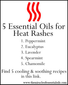 5 Essential Oils for Heat Rash including 5 Recipes for Quick Relief ...