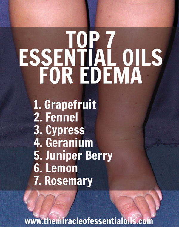 7 Essential Oils For Edema Plus 3 Recipes To Use The Miracle Of Essential Oils