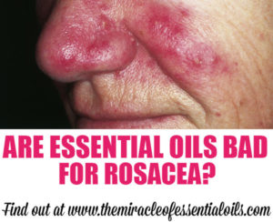 Are Essential Oils Bad for Rosacea? - The Miracle of Essential Oils
