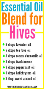 DIY Essential Oil Blend for Hives - The Miracle of Essential Oils